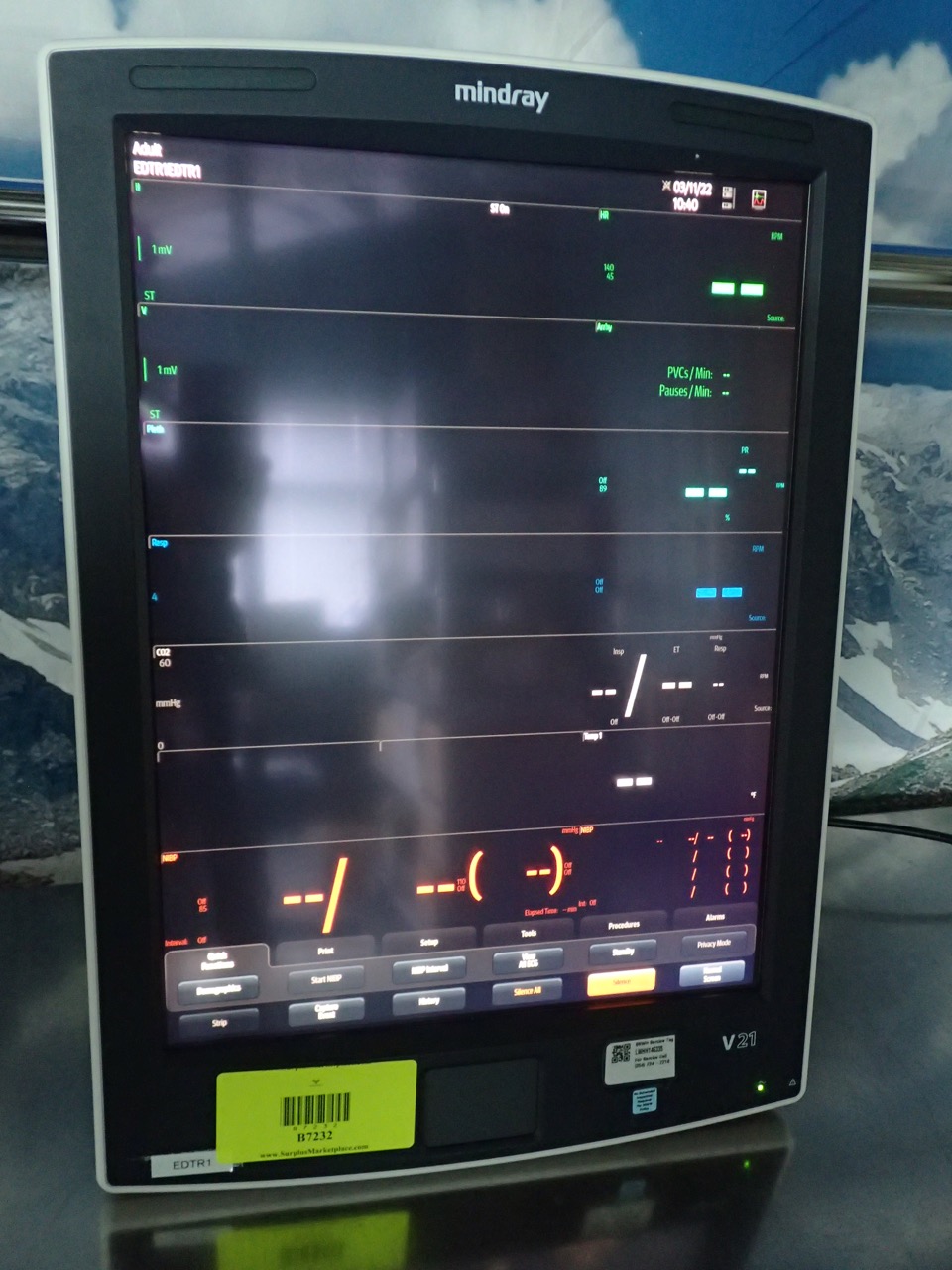 Mindray V21 Patient Monitor | Surplus Marketplace