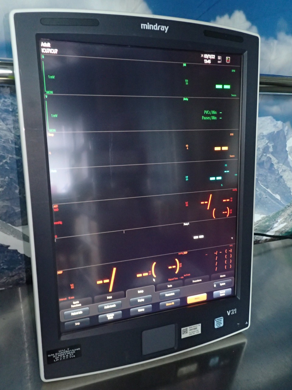 Mindray V21 Patient Monitor | Surplus Marketplace