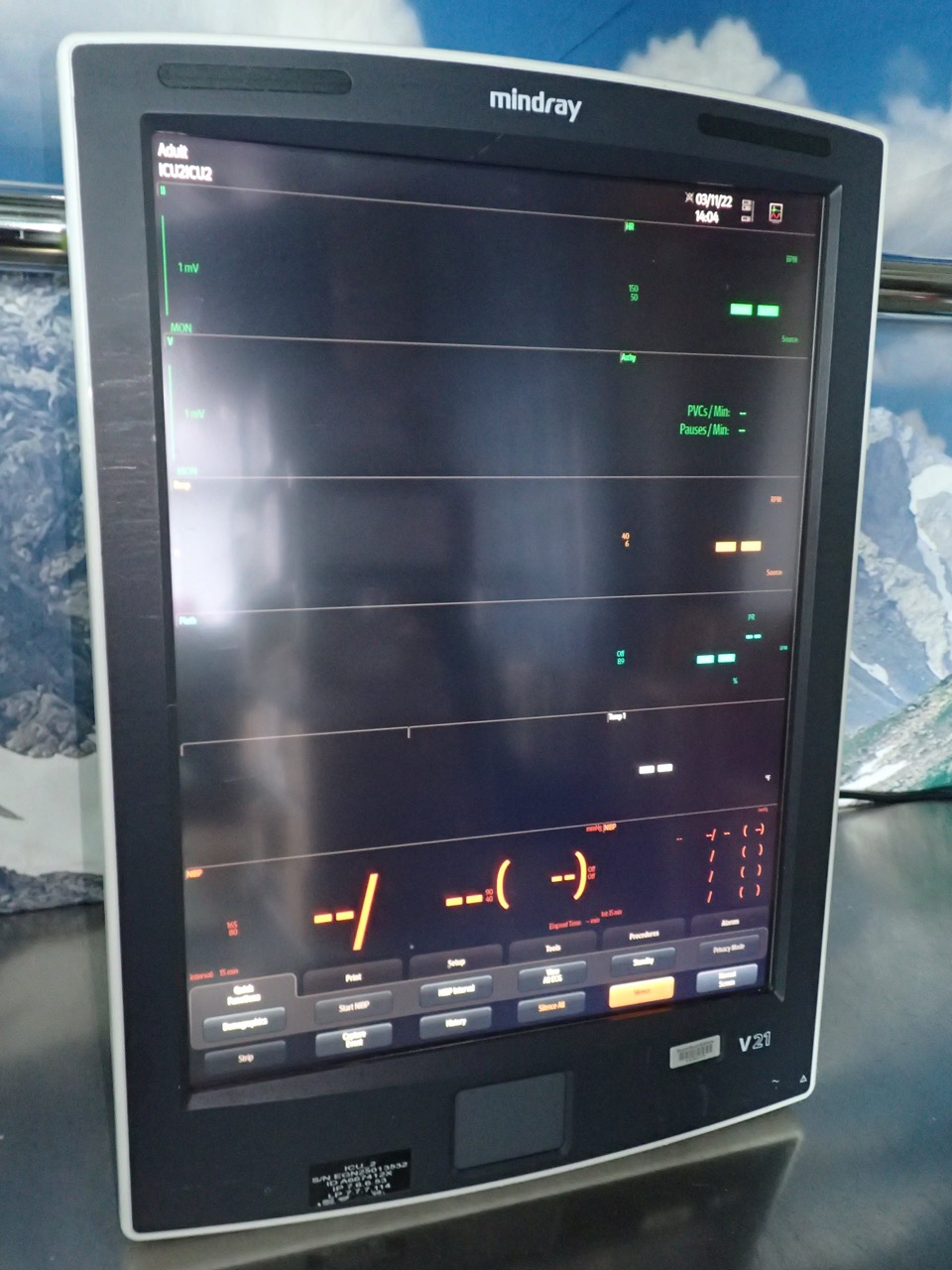 Mindray V21 Patient Monitor | Surplus Marketplace