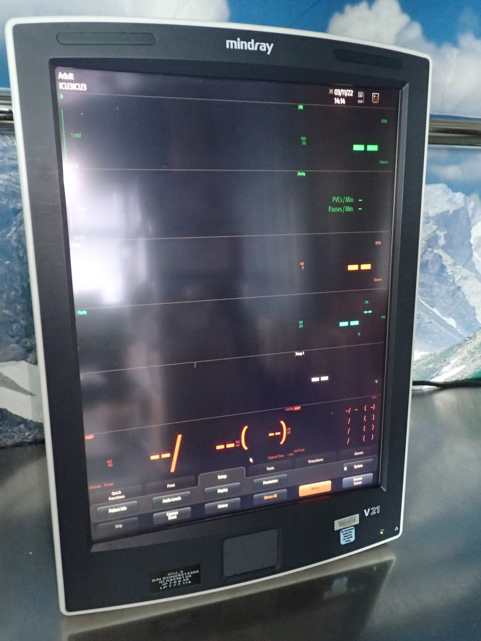Mindray V21 Patient Monitor | Surplus Marketplace