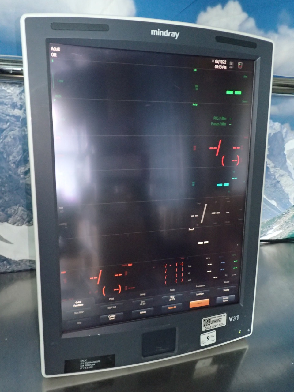 Mindray V21 Patient Monitor | Surplus Marketplace