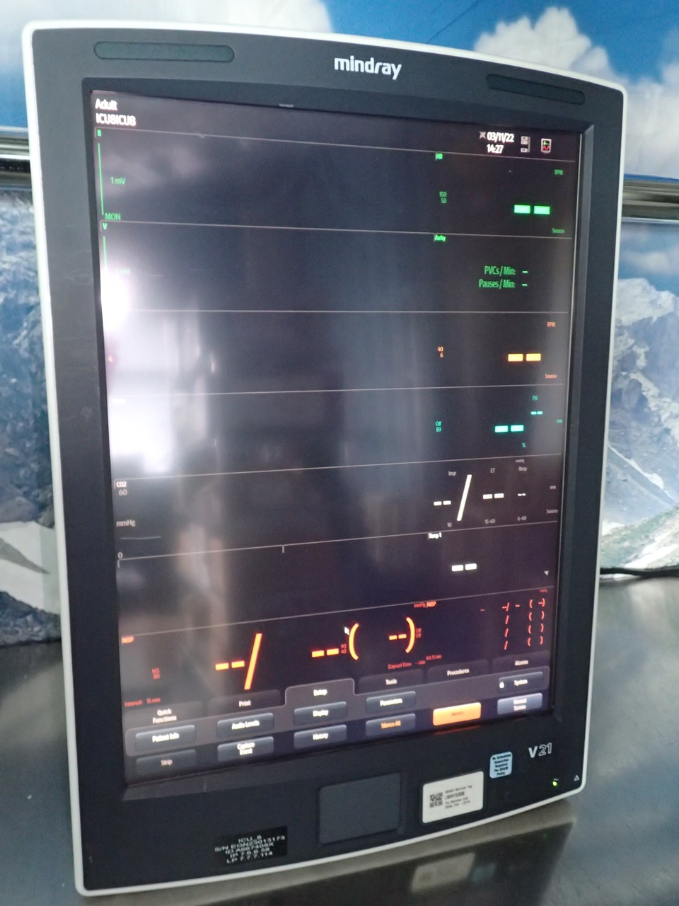 Mindray V21 Patient Monitor | Surplus Marketplace