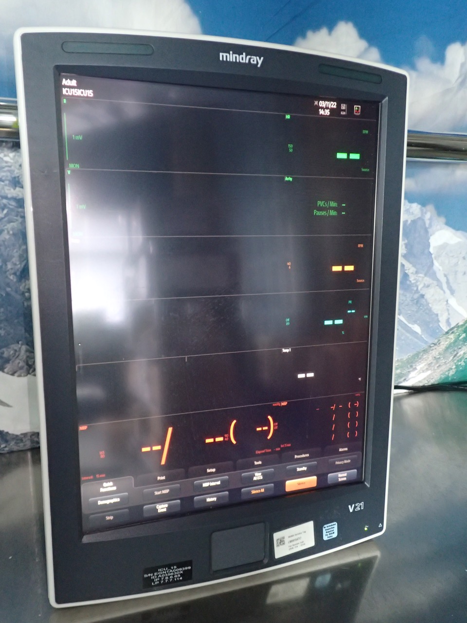 Mindray V21 Patient Monitor | Surplus Marketplace