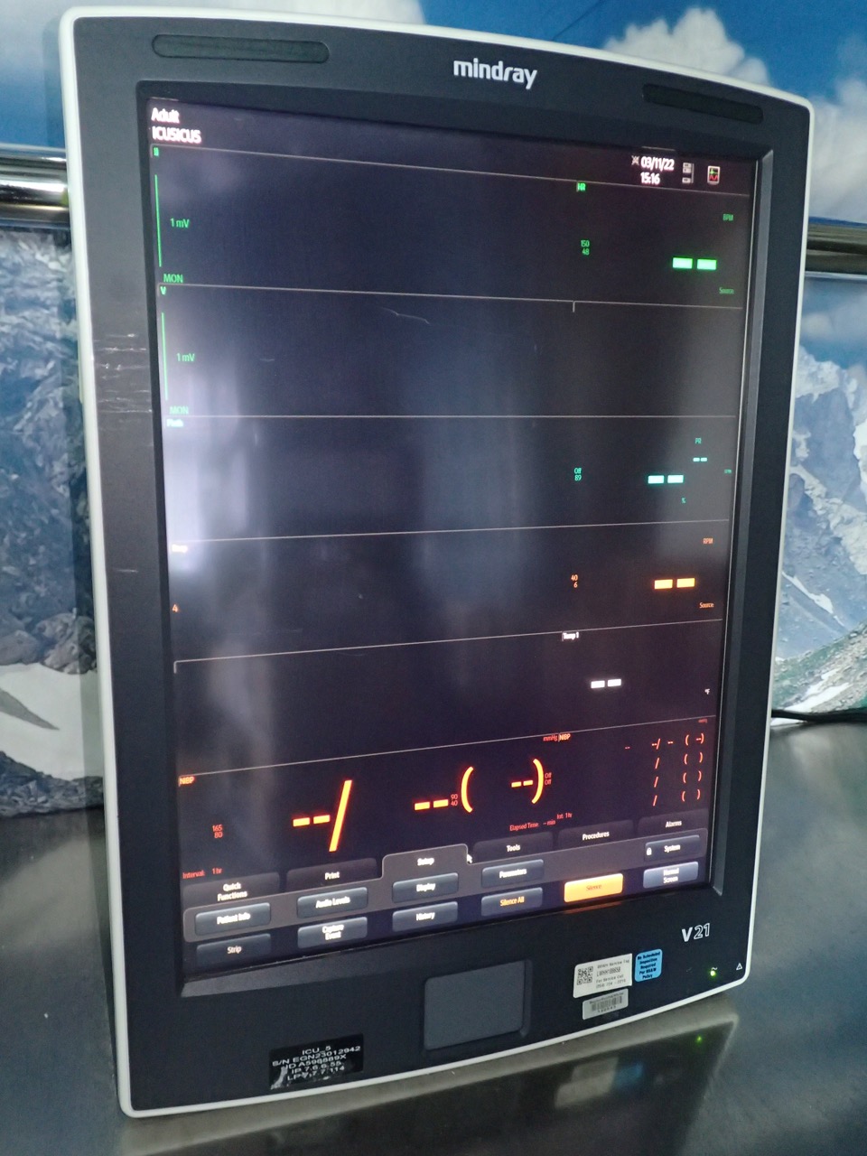 Mindray V21 Patient Monitor | Surplus Marketplace