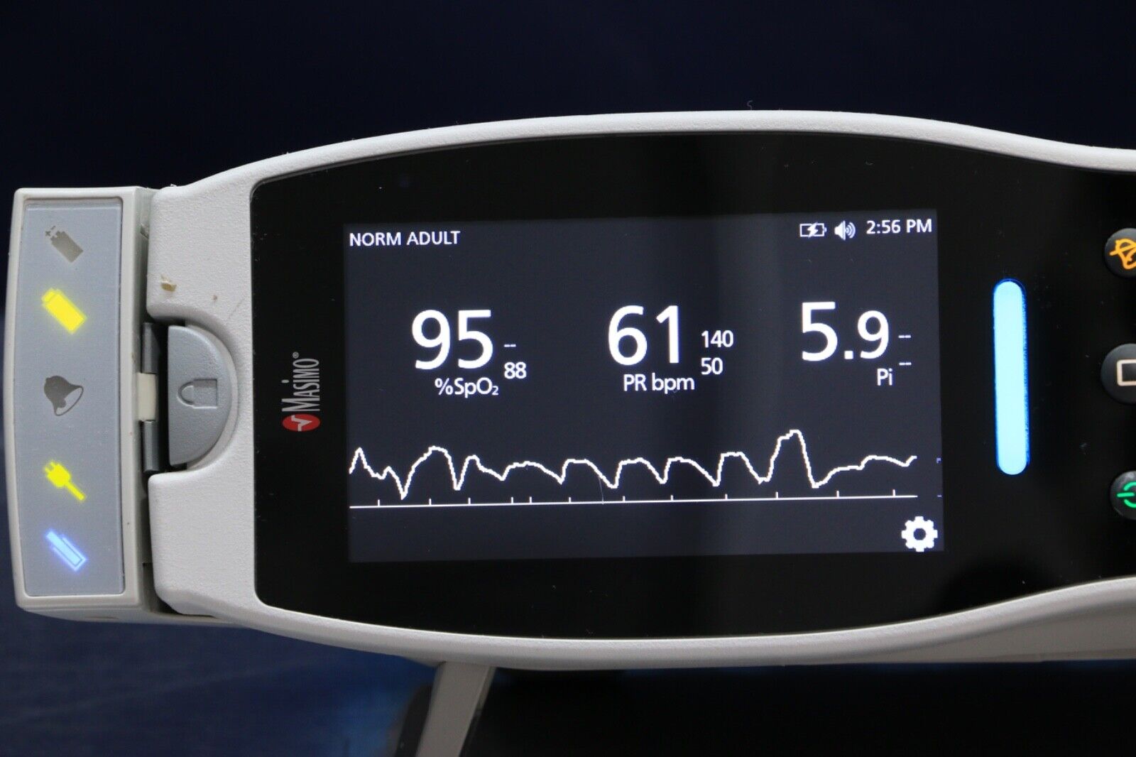 Masimo Radical-7 Rainbow Touch Pulse Oximeter | Surplus Marketplace