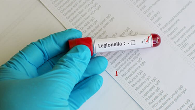 Legionella - Everything you need to know, including how | Phoenix ...
