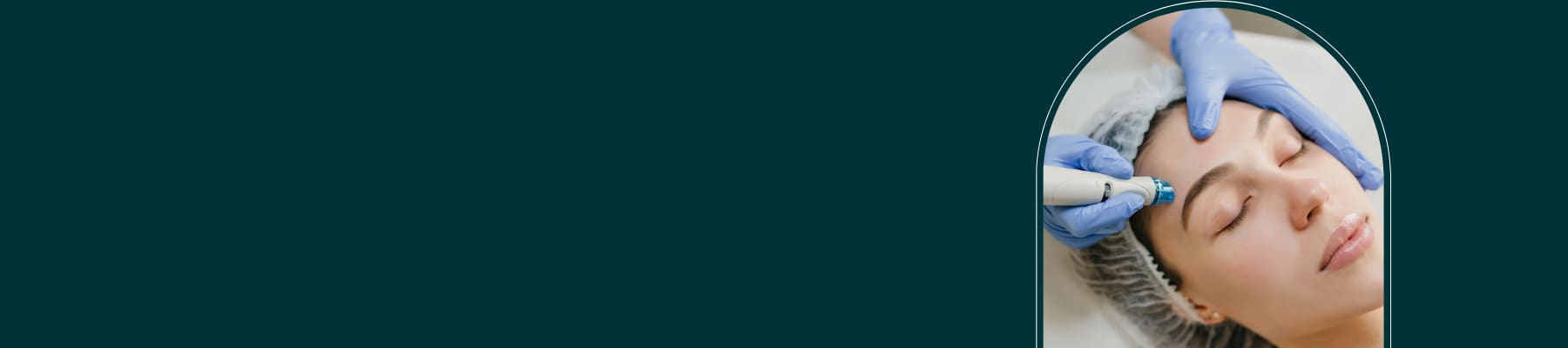 Top Dermapen Services in Surat near me | Sculpt Skin Care