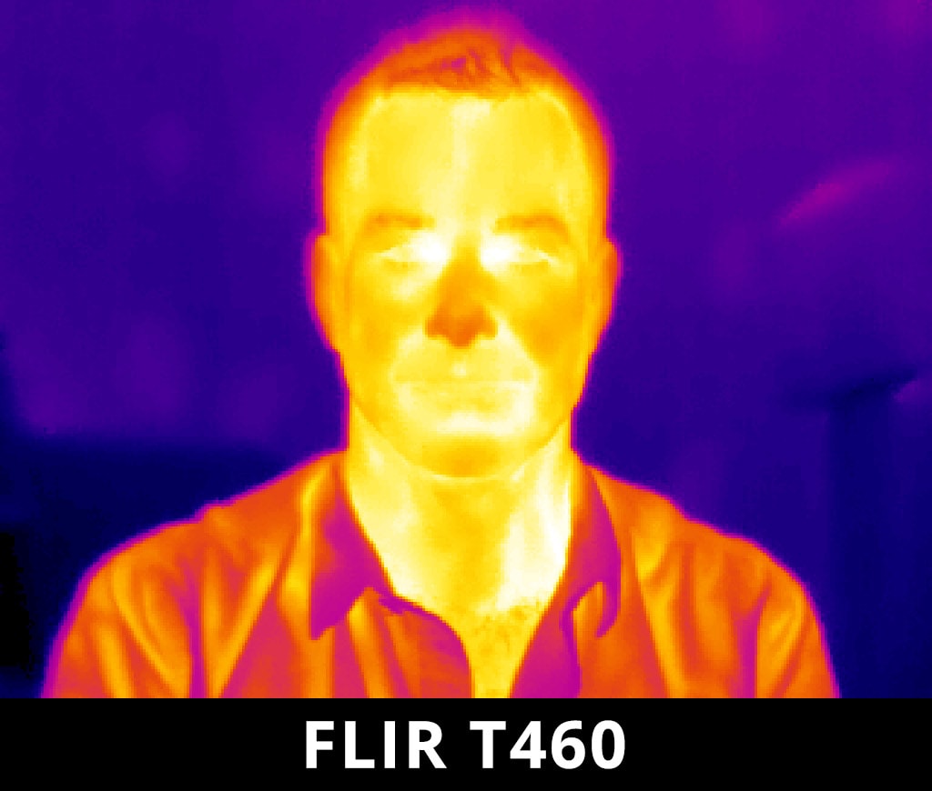 Thermal Imaging Camera Resolution Comparison for Medical Applications ...
