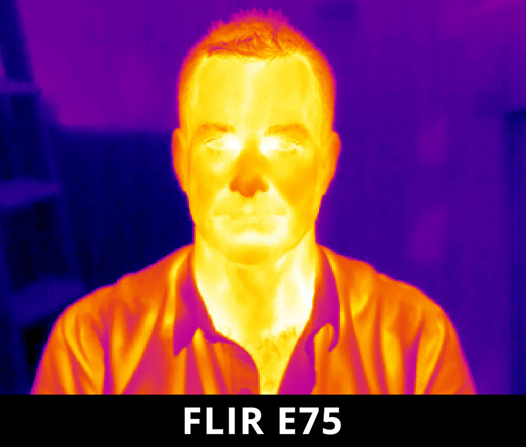 Thermal Imaging Camera Resolution Comparison for Medical Applications ...