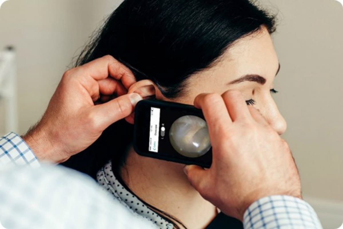 Jetzt kommt das «Smartphone-Otoskop»