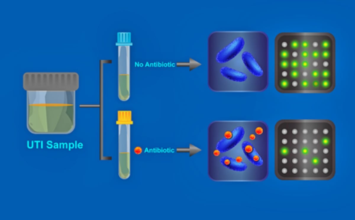 Test findet richtiges Antibiotikum innert wenigen Minuten