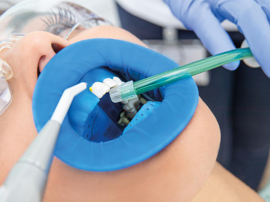 OptraDam Plus Regular - denta.be