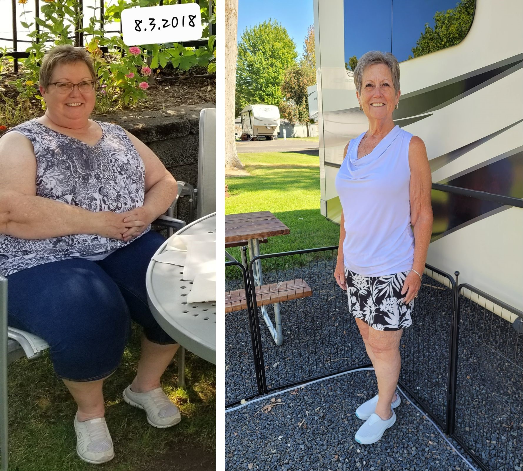 Bariatric surgery helps 69-year-old woman enjoy retirement - MultiCare ...