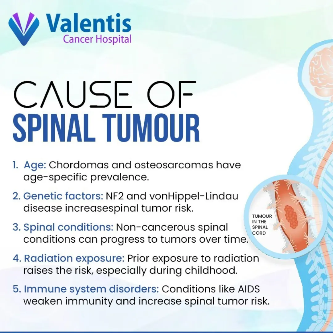 Let Know about Spine Tumor: Causes, Symptoms, and Treatment