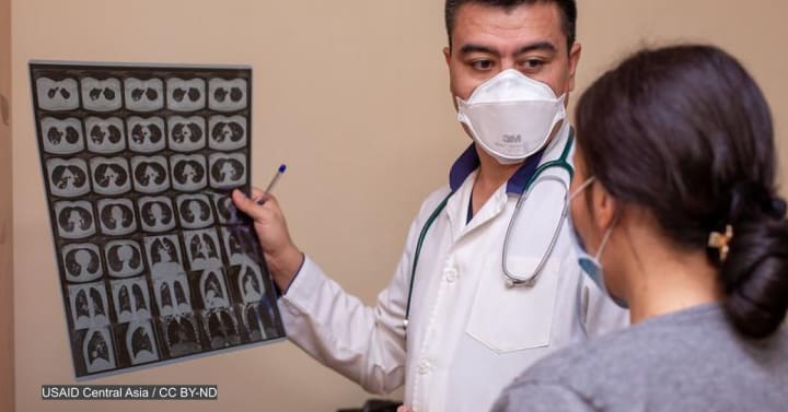 Opinion: To recover from COVID-19, donor support for tuberculosis must ...