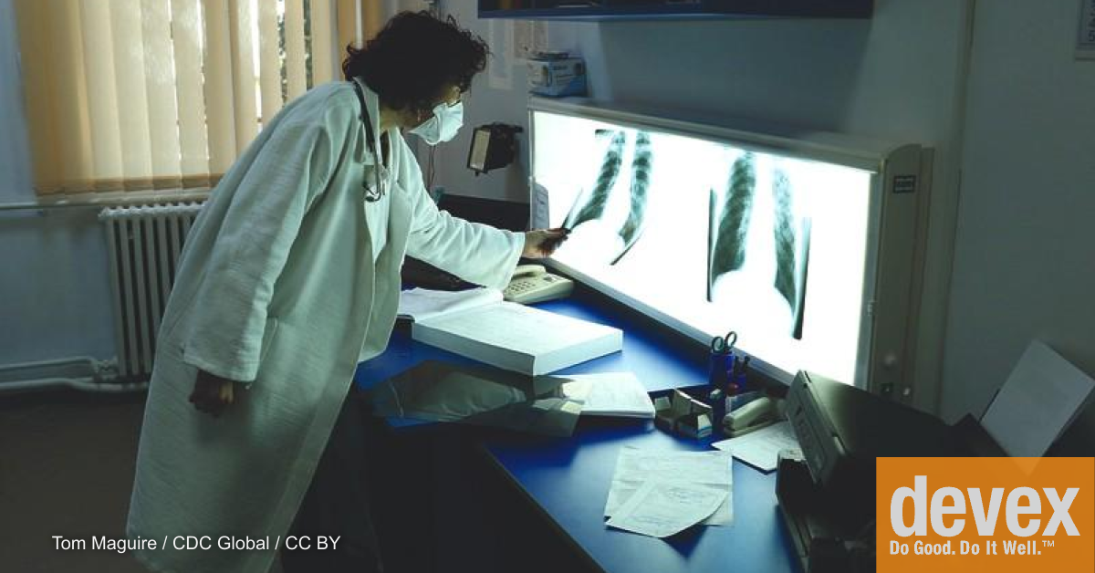 What does a future with AI-aided TB screening look like? | Devex