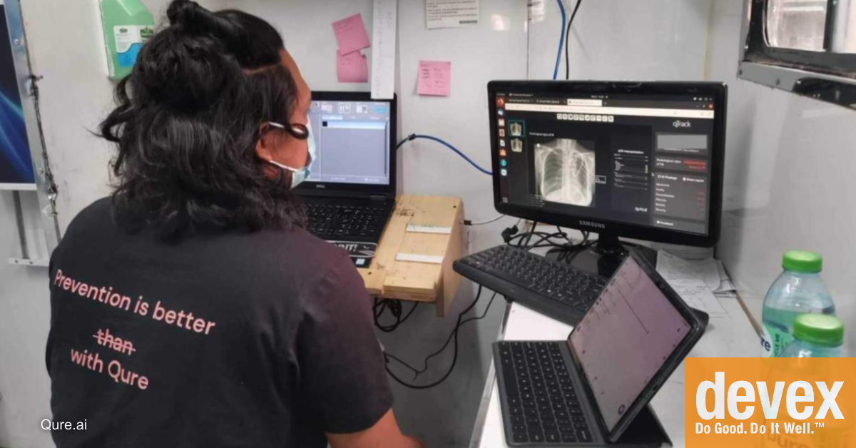 Opinion: How AI can rejuvenate imaging equipment to ramp up TB screening | Devex
