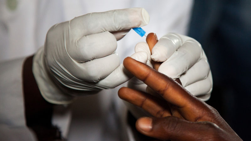 Q&A: Diagnostic tools as the answer to HIV and AIDS | Devex