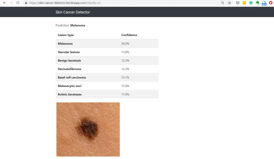 Skin-Cancer-Detection-TransferLearning-Fastai-Flask | Devpost