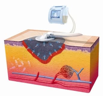 Get Best Difficult Wound Treatment in Delhi - Dr. Ashok Tandon