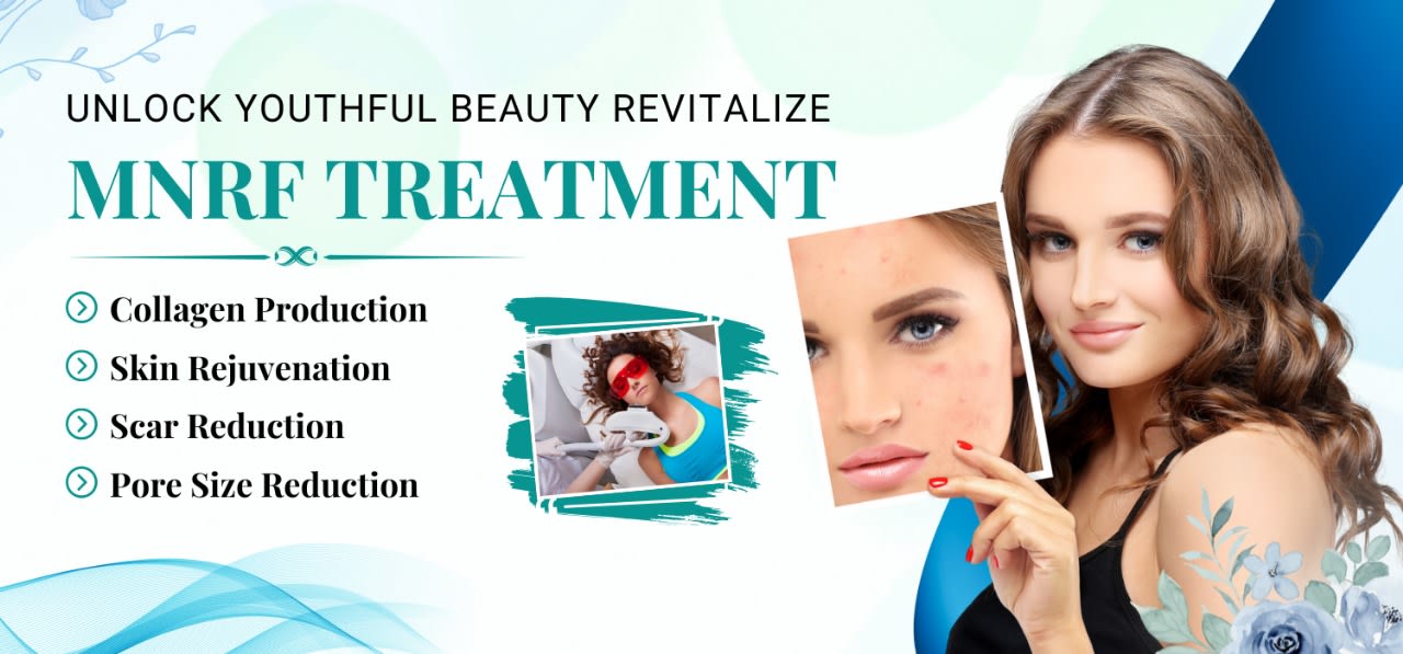 MNRF Treatment in Jalandhar - Dr. Shivani's Clinic