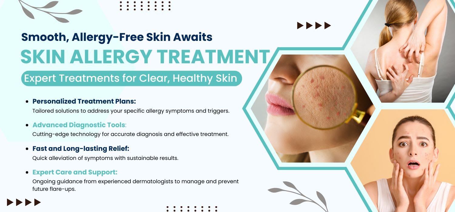 Skin Allergy Treatment in Jalandhar - Dr Shivani's Skin Clinic