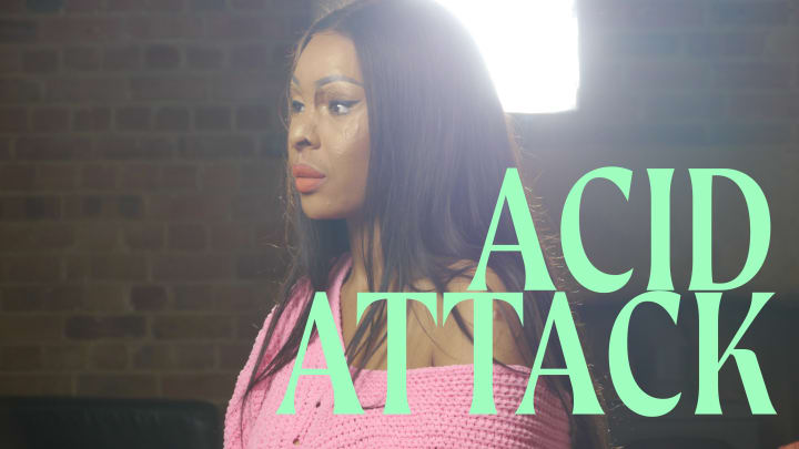 Acid Attack: My Story