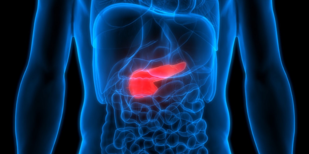 New Evidence Links Cannabis to Acute Pancreatitis