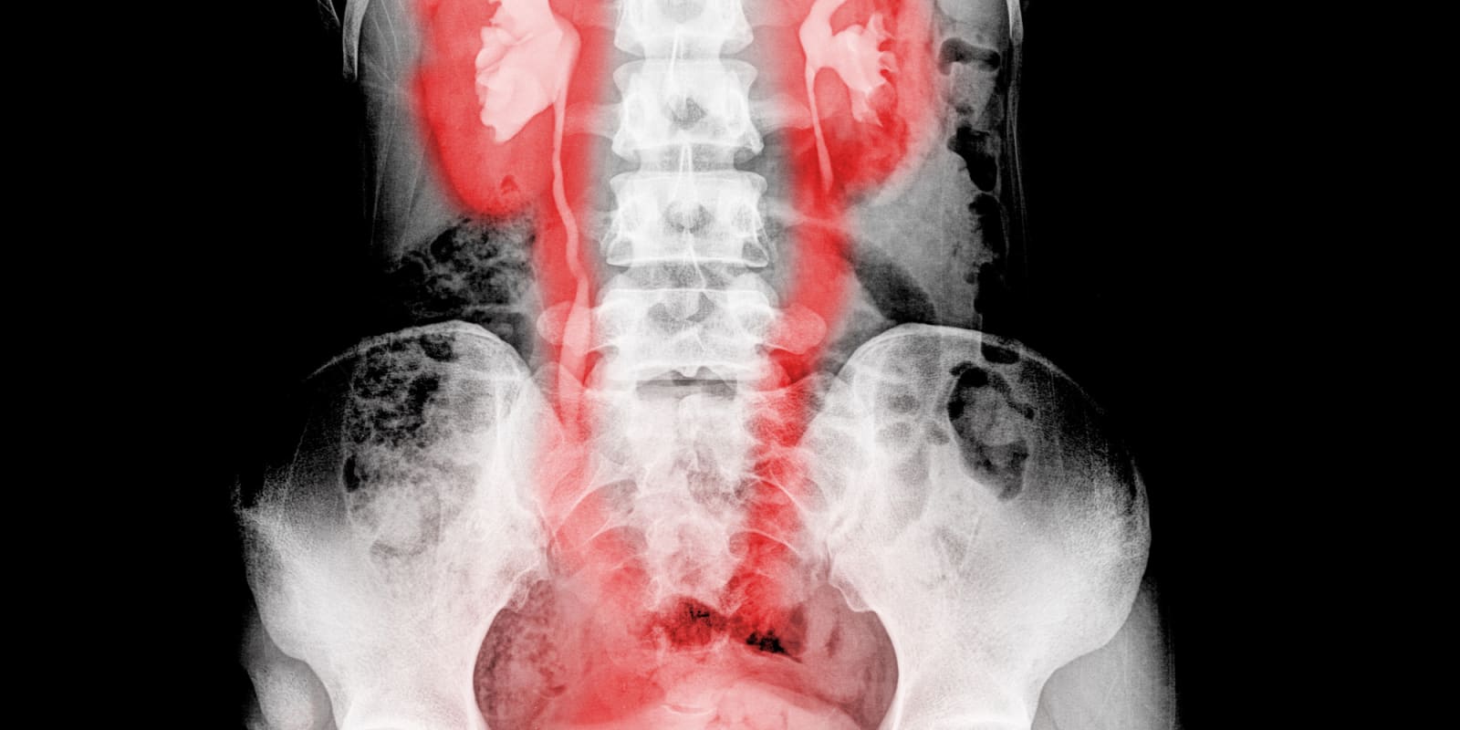 What’s New in GU Malignancy? Update from ASCO 2019