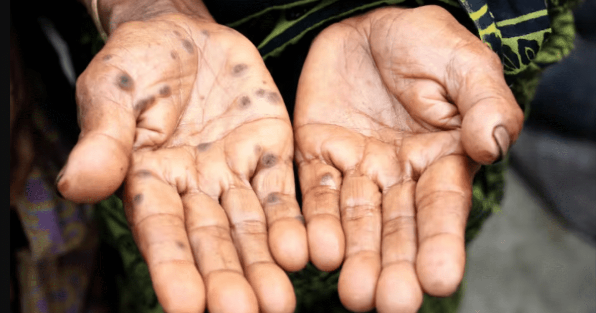 Arsenic contamination of food and water is a global public health ...