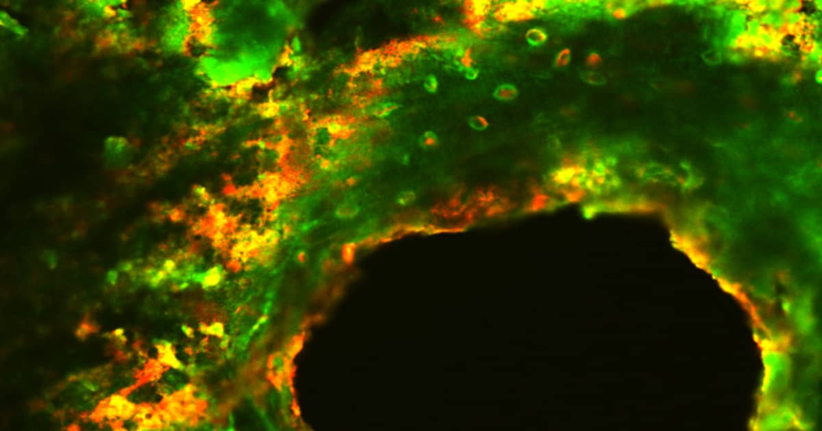 Research Snapshot: Growing 3D bone in the lab | FIU News - Florida ...