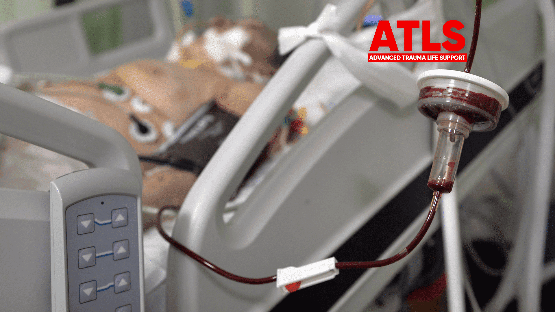 Геморагічний шок: ATLS Розділ 3: Стан шоку - GUMKA - Global Ukrainian ...