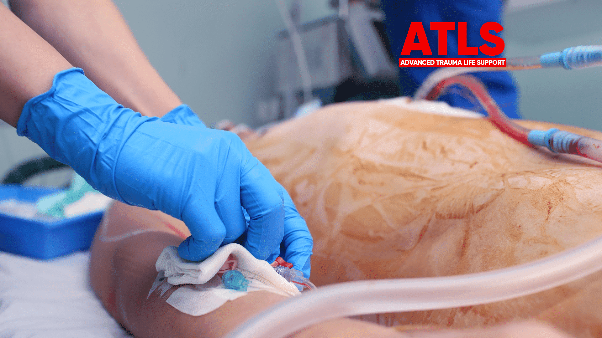 ATLS Розділ 4: Травма грудної клітки ATLS – посібник по лікуванню ...