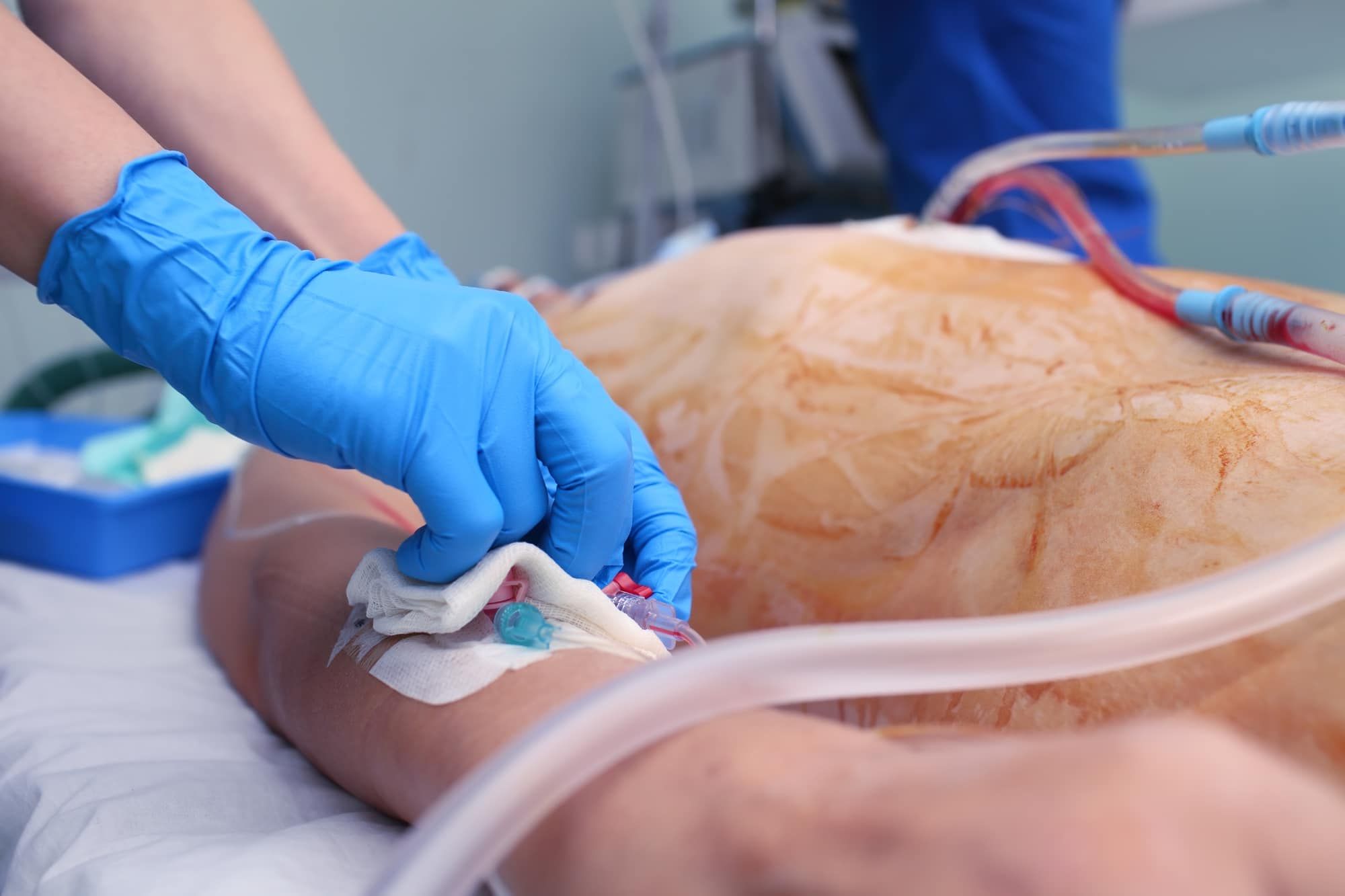 Venous Access Trauma Surgery - GMKA - Global Medical Knowledge Alliance