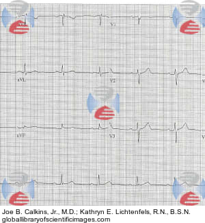 Recognition of Errors in ECG Recordings | Global Library of Scientific ...