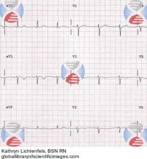 Dextrocardia Figure A | Global Library of Scientific Images