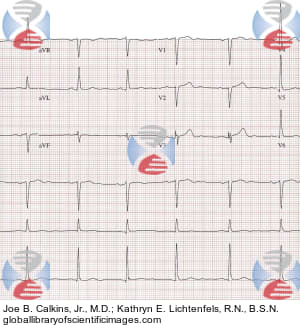 Recognition of Errors in ECG Recordings | Global Library of Scientific ...