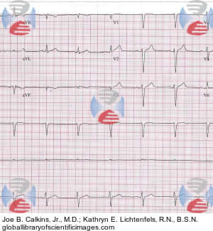Recognition of Errors in ECG Recordings | Global Library of Scientific ...
