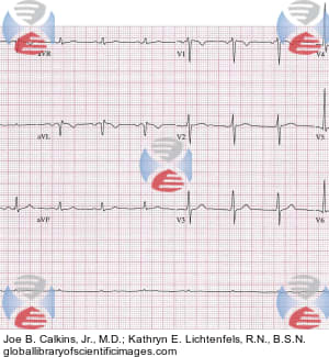 Recognition of Errors in ECG Recordings | Global Library of Scientific ...