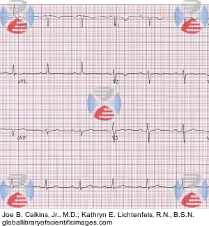 Recognition of Errors in ECG Recordings | Global Library of Scientific ...