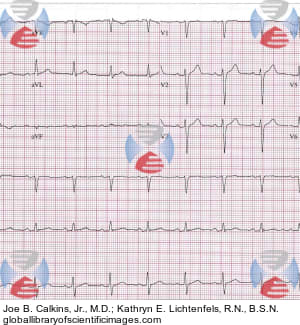 Recognition of Errors in ECG Recordings | Global Library of Scientific ...