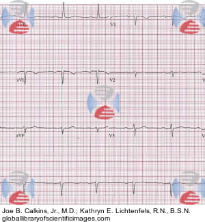 Recognition of Errors in ECG Recordings | Global Library of Scientific ...