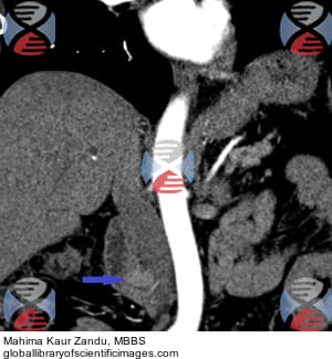 Double duct sign | Global Library of Scientific Images