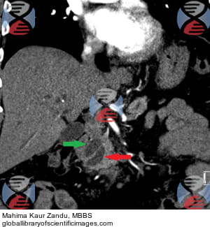 Double duct sign | Global Library of Scientific Images