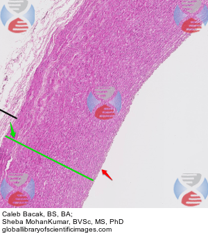Aorta Slide Labeled