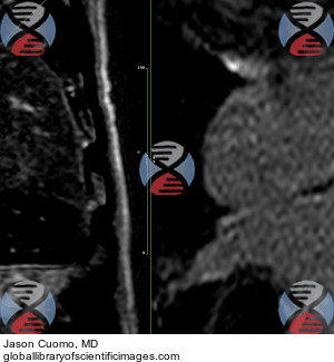 Imaging in orthogonal planes | Global Library of Scientific Images