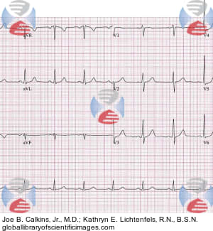 Recognition of Errors in ECG Recordings | Global Library of Scientific ...