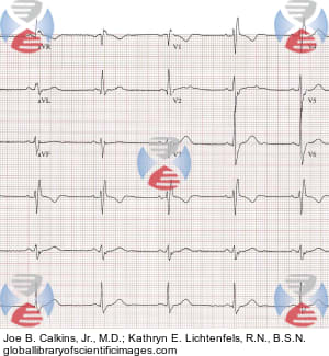Recognition of Errors in ECG Recordings | Global Library of Scientific ...