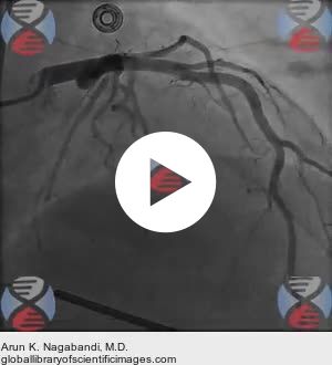Diagnostic Coronary Angiogram | Global Library of Scientific Images