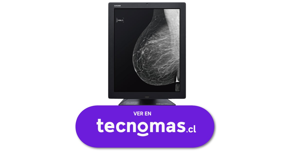 tecnomas.cl | [JUSHA-M53] Monitor Diagnostico Mamografía JUSHA M53,
